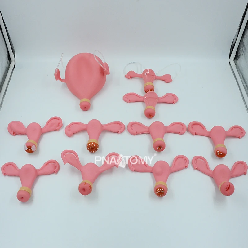 Gynecological Examination Model - Female Uterus Manikin
