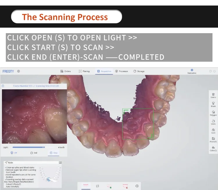 Zahndent 3 Different Tips Autoclavable Intraoral Scanner Cad Cam System ...