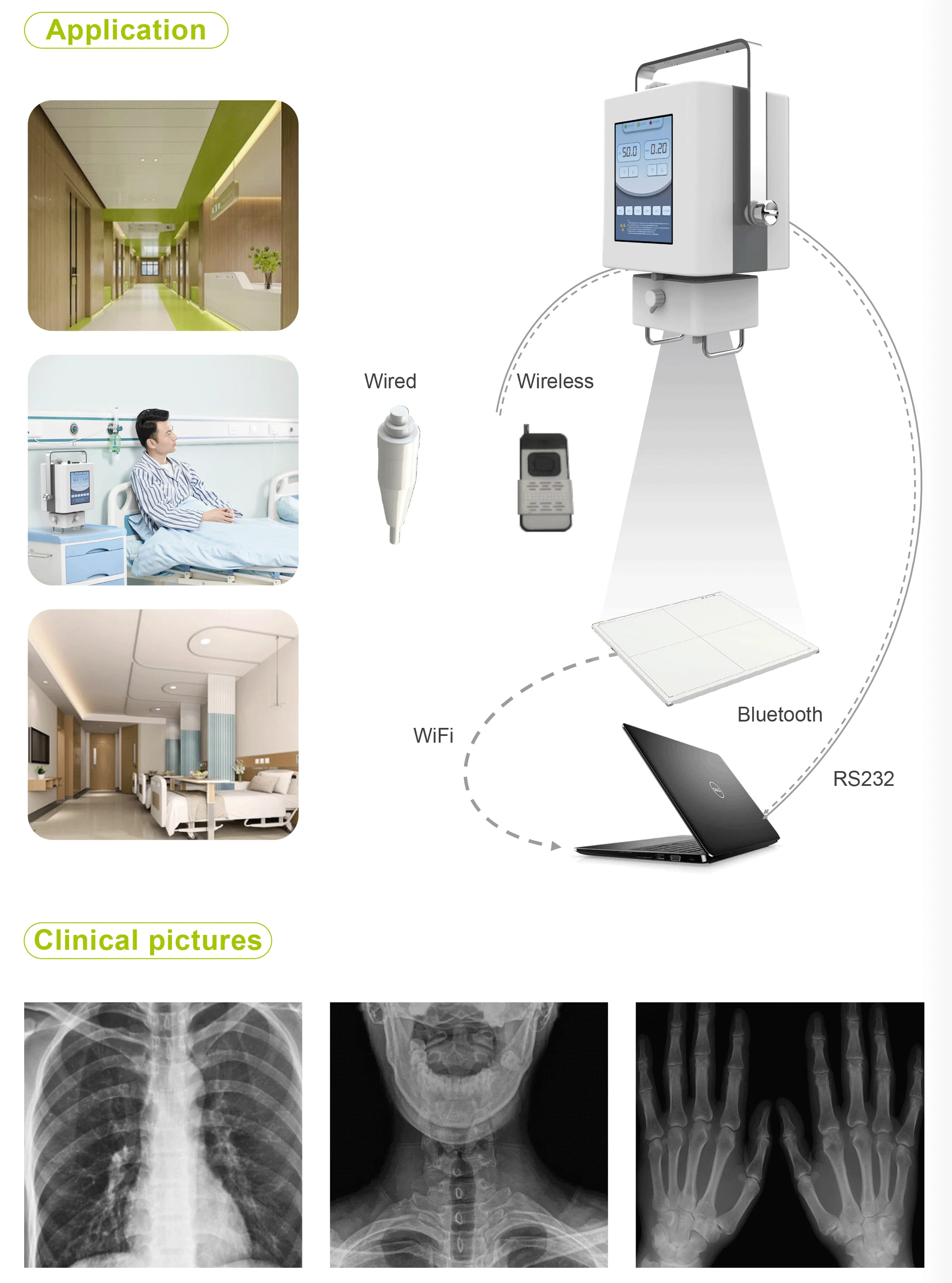 Portable X Ray Machine - 5.3kw Digital Radiography System