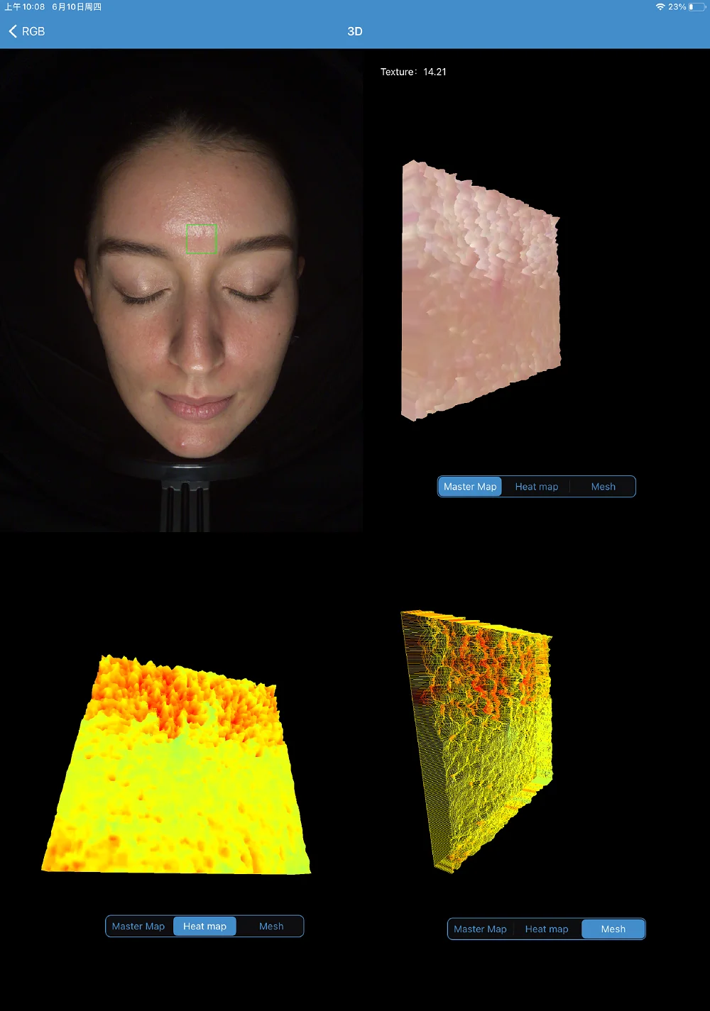 UV Light Facial Skin Scanner - Meicet MC10 Skin Analyzer