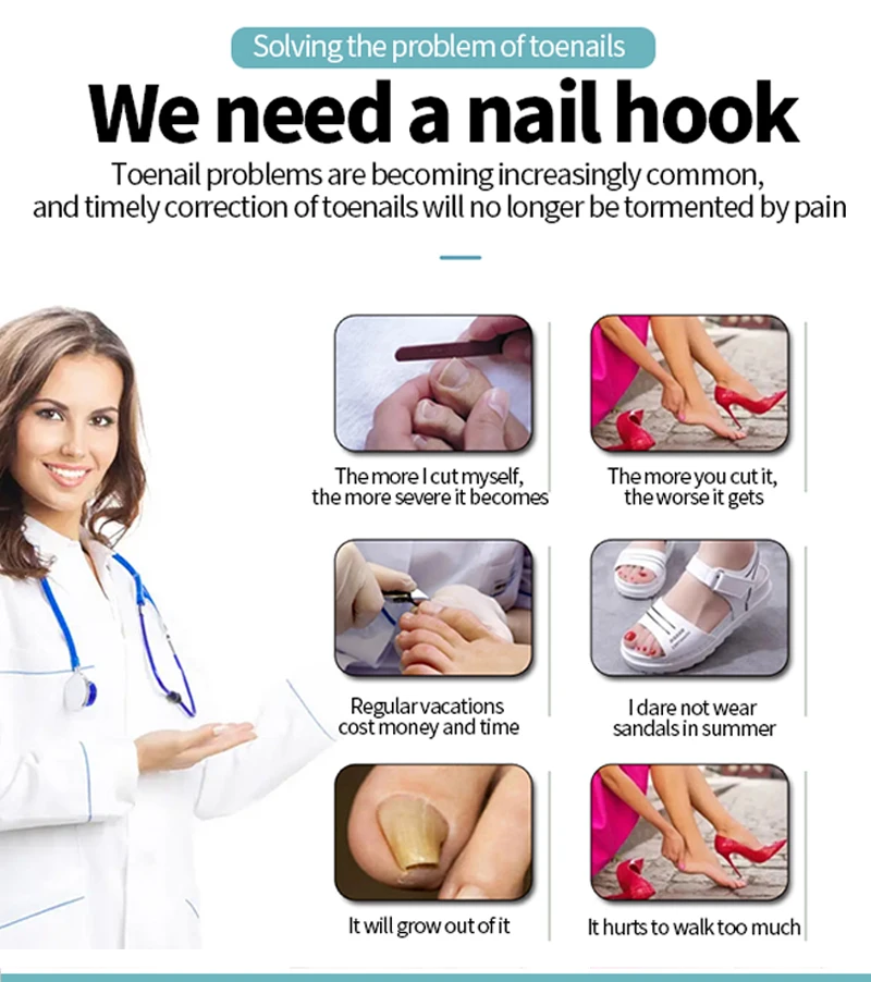 Ingrown Nail Hooktoenail Corrector Orthotic Nail Fixer Toenail ...