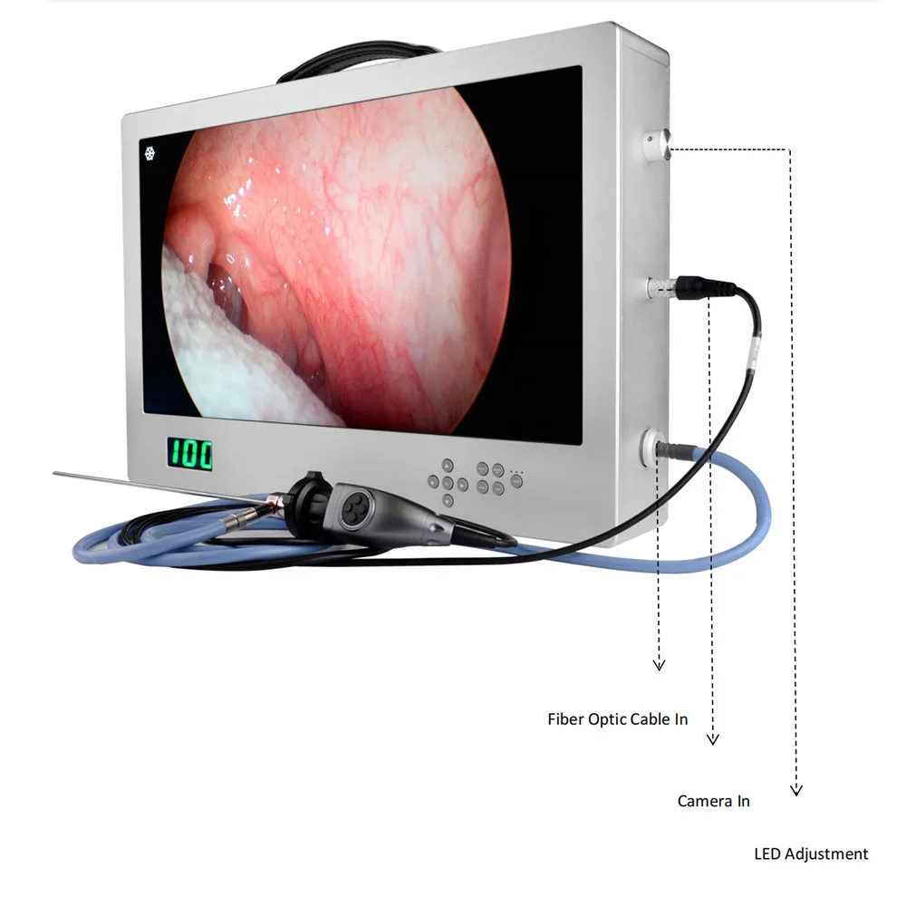 4 in 1 Integrated Endoscope Camera System All in One Medical Portable ...