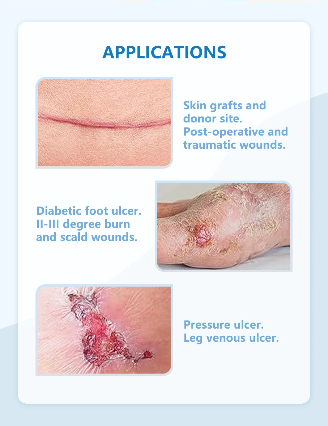 Bluenjoy Pressure Ulcer Silicone Foam Dressing With Pad Hydrophilic ...