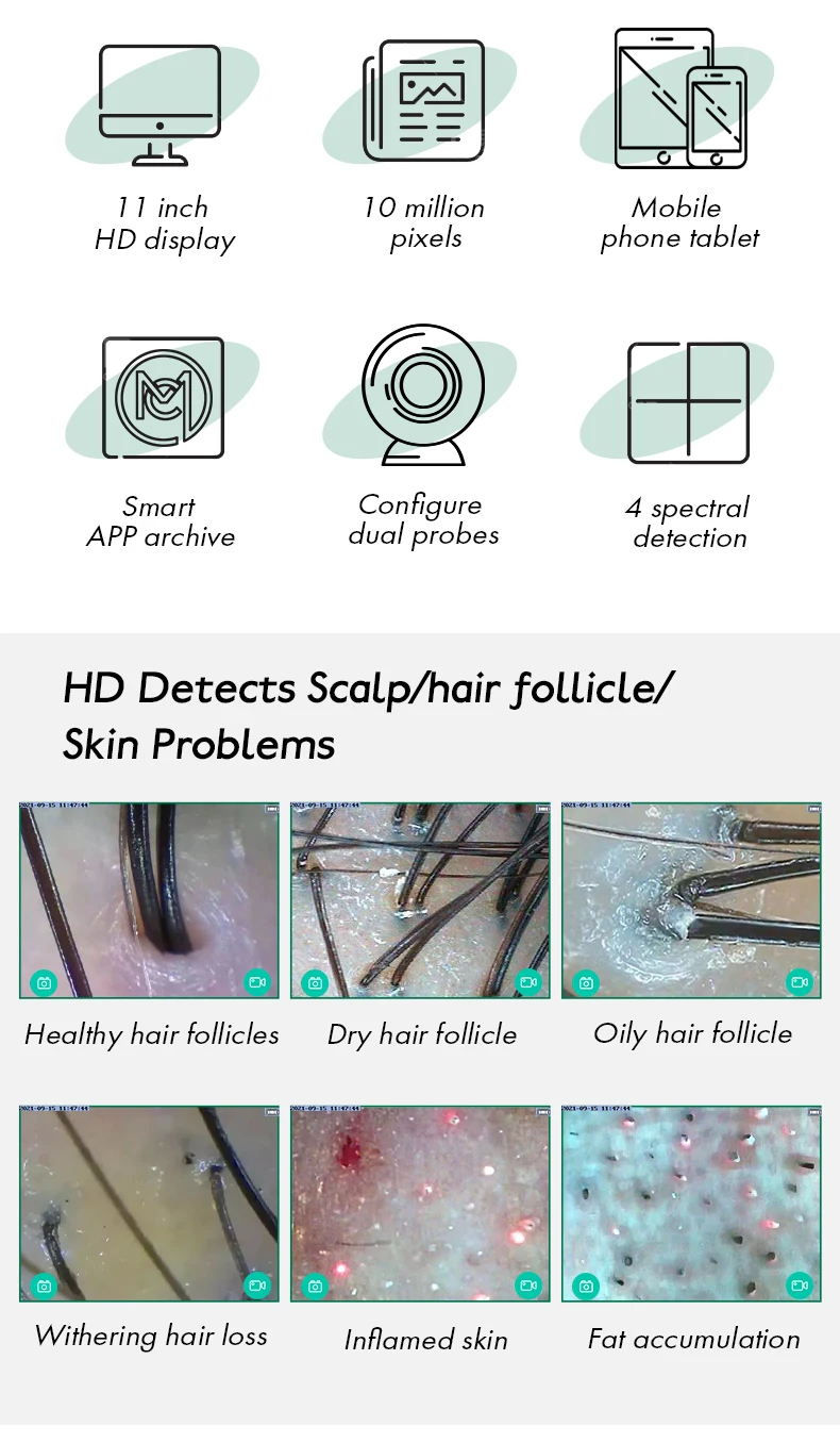 Meiboyi Can Create Customer Profile Scalp Microscope Camera HD