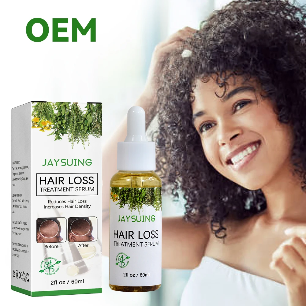 Aromlife Private Label Rosemary Hair Growth Oil Product For Black Women