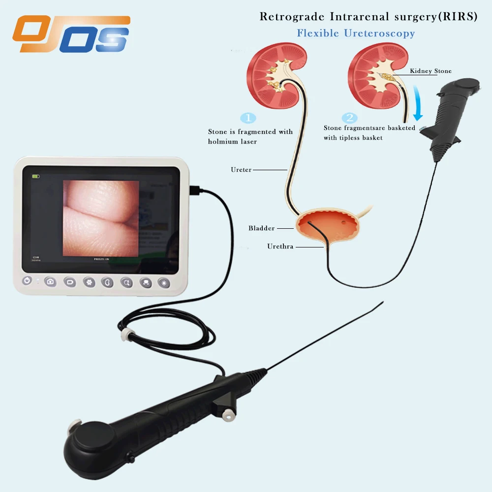 Single Use Portable Digital Video Flexible Ureteroscope Disposable ...