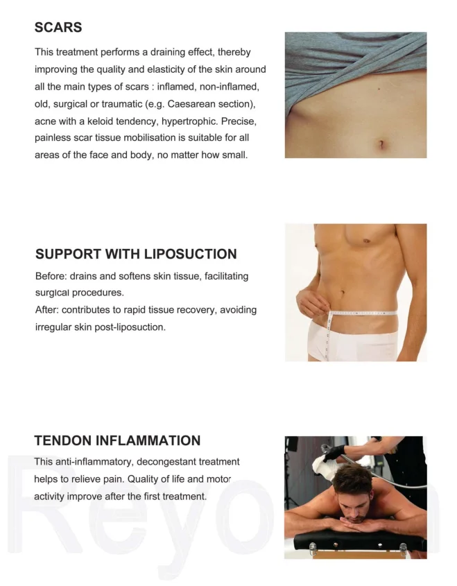 V Shape 3 Lipo 80k Rf Vacuum Cavitation System Slimming Roller ...