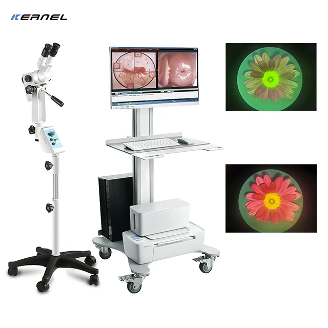 Factory Price Kernel Kn 2200bi Portable Gynecological Colposcopio Set ...