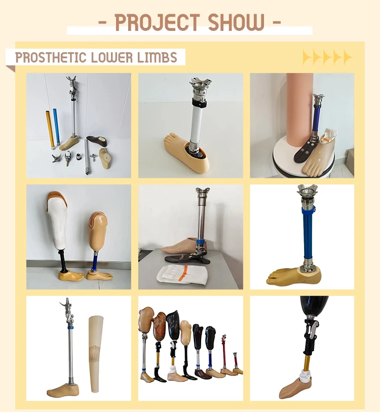 Artificial Limb Prosthetic Feet Elastic High Ankle Carbon Fiber Storage ...