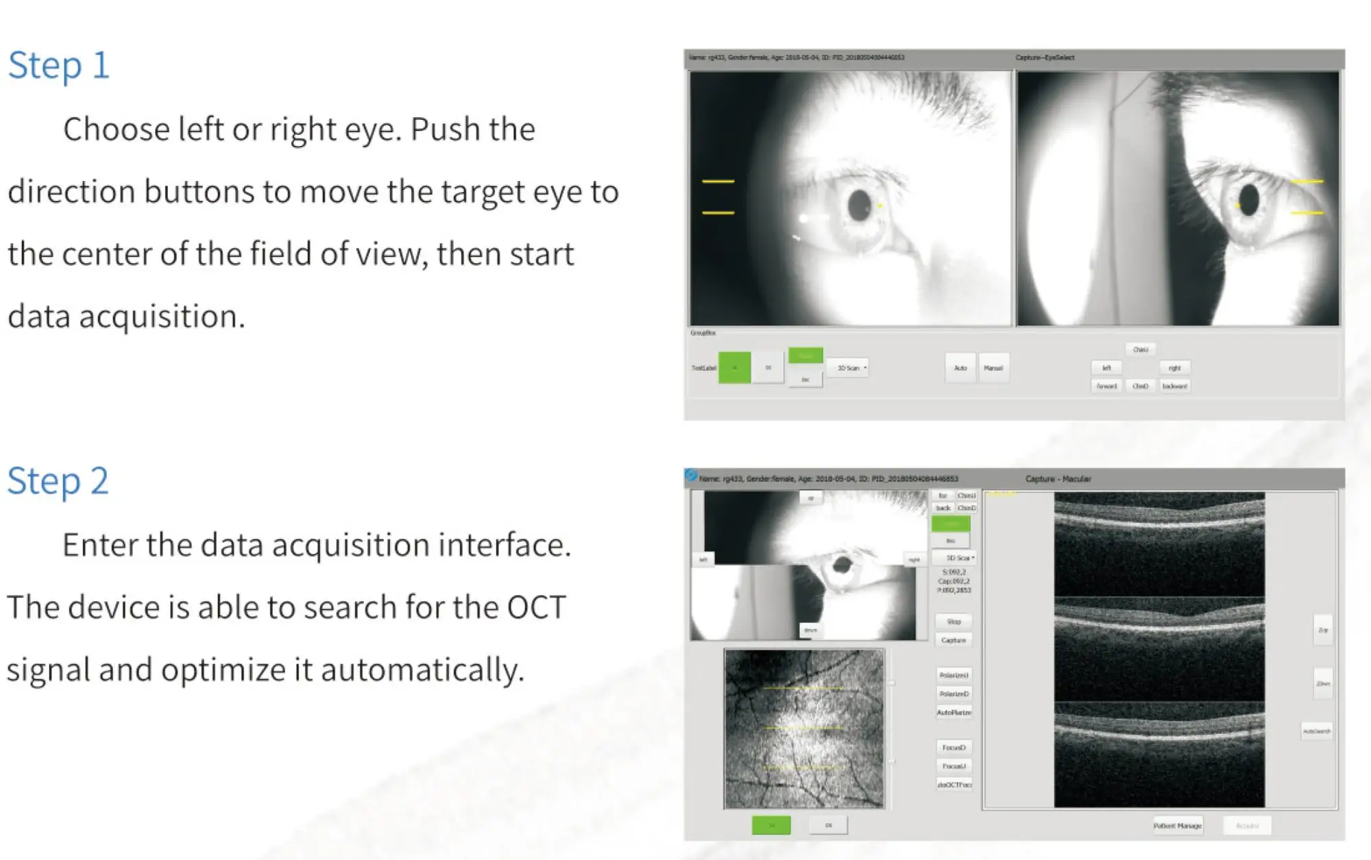 Optical Coherence Tomography OCT-500-企业官网