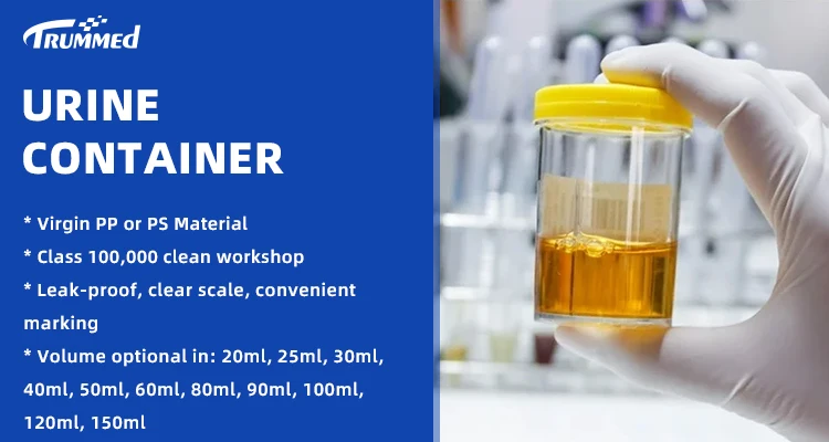 EO Sterile Labeled Urine Specimen Container 90 ml in Temperature Strip ...