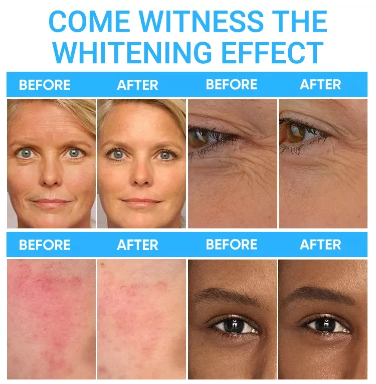 Detvfo Effective Glutathione Arbutin Dark Knuckle Bleaching Cream Skin ...