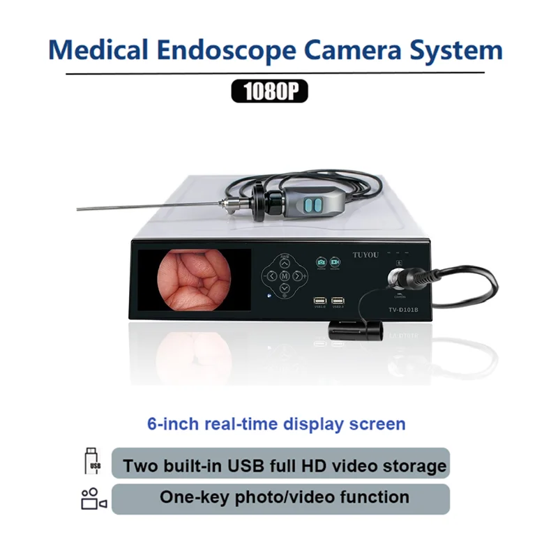 Manufacturer Price 1080P HD Medical Endoscope Machine Video Endoscopy ...