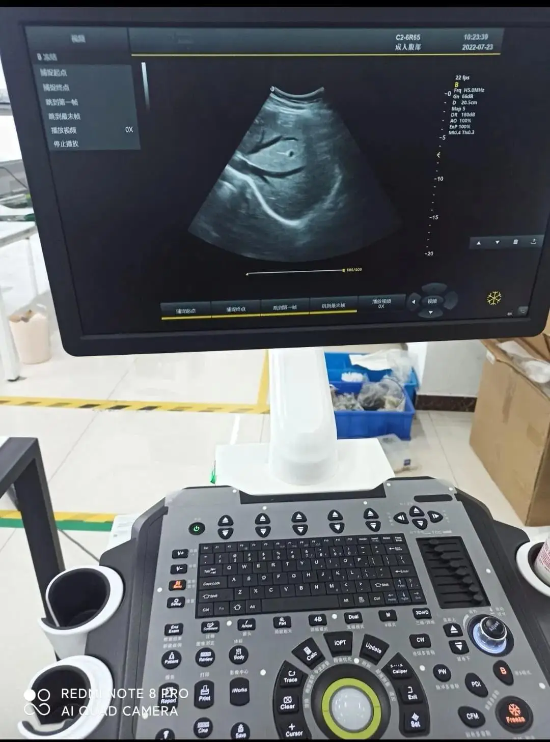 Portable Color Doppler Ultrasound 3D/4D/5D F3 Veterinary Applications ...