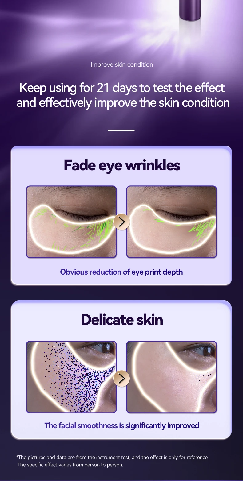 Kks Anti-aging Ems Microcurrent Eye Beauty Wand Neck Face Massager 4-in ...