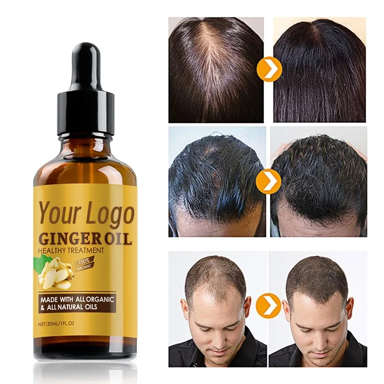 Oem Ginger Hair Growth Serum Natural Organic Custom Hair Care Hair Loss ...