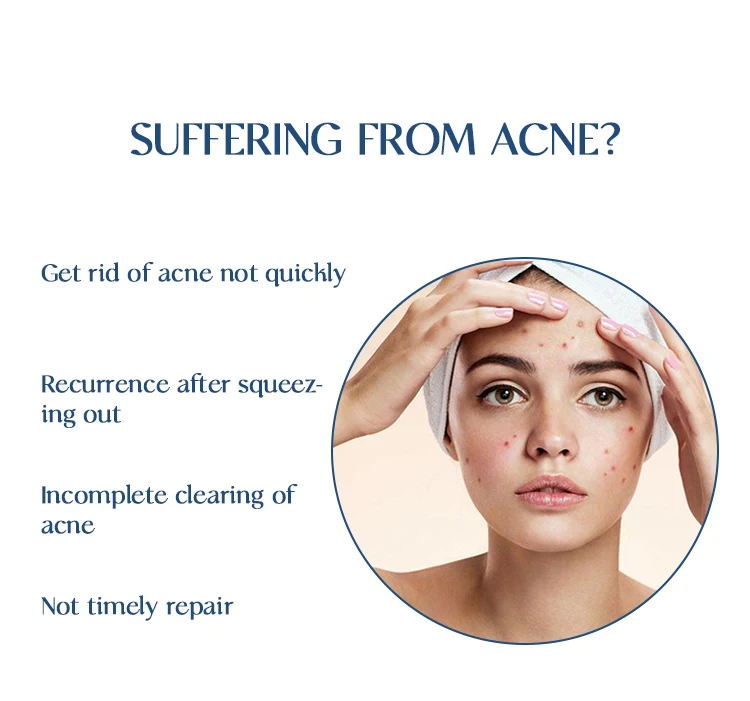 Micro-needle Acne Patch with Hyaluronic Acid - Fast Healing