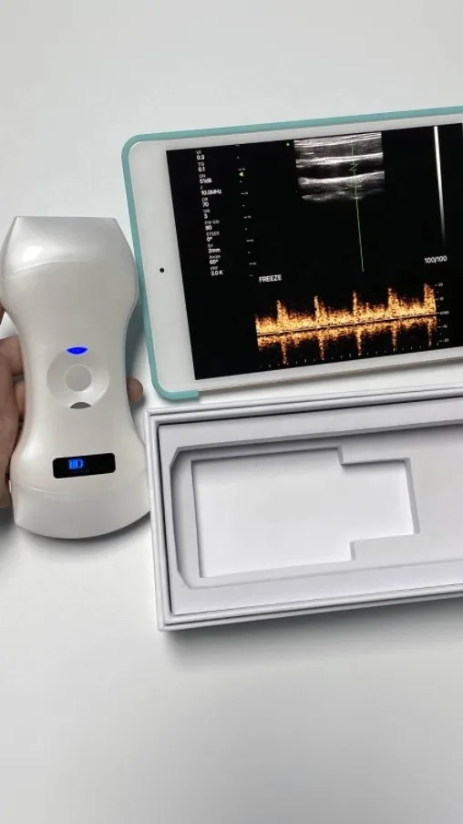 Portable Ultrasound Scanner Doppler Linear Convex Phased Usb Wifi ...