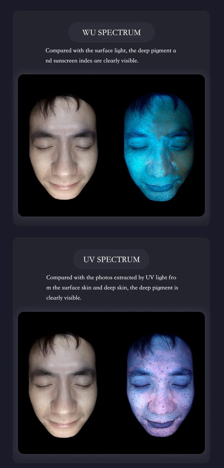 Facial Skin Analyzer Machine Portable Visia Skin Analysis System For In ...