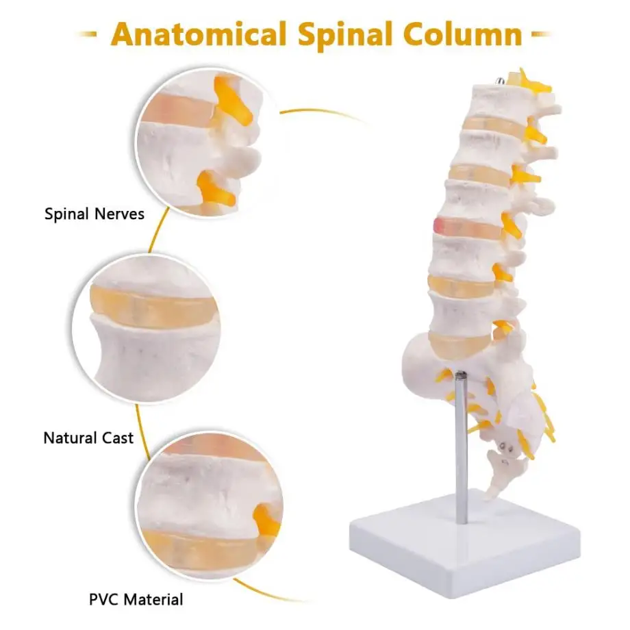Medical Teaching Lumbar Vertebrae with Sacrum & Coccyx and Herniated ...