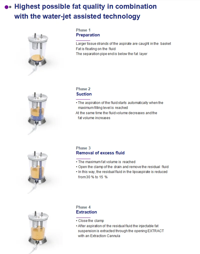 Hot Sale Autoclavable Fat Transplant Filter System - Greatlh