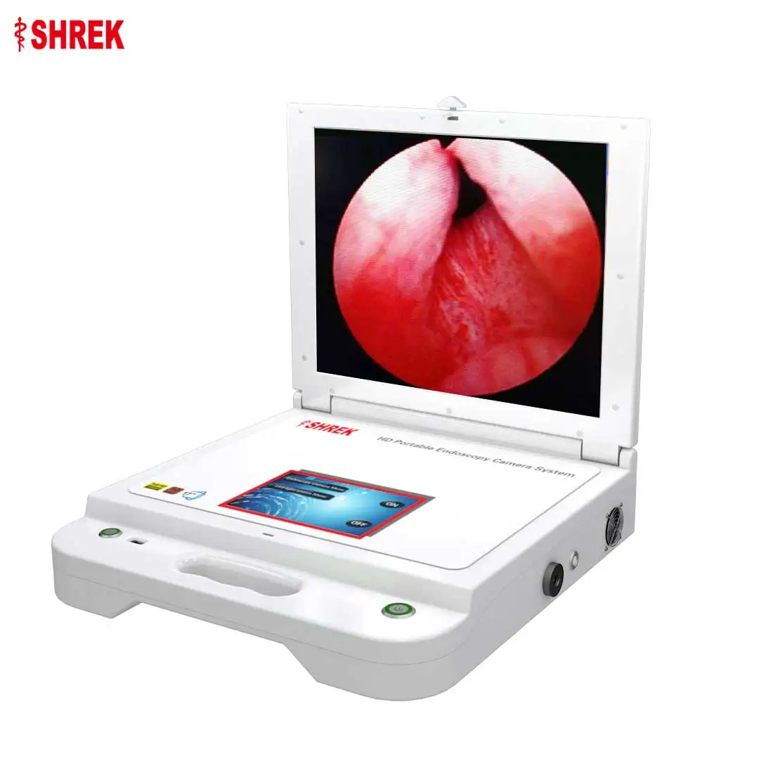 Portable Medical Integrated Camera Endoscopy System