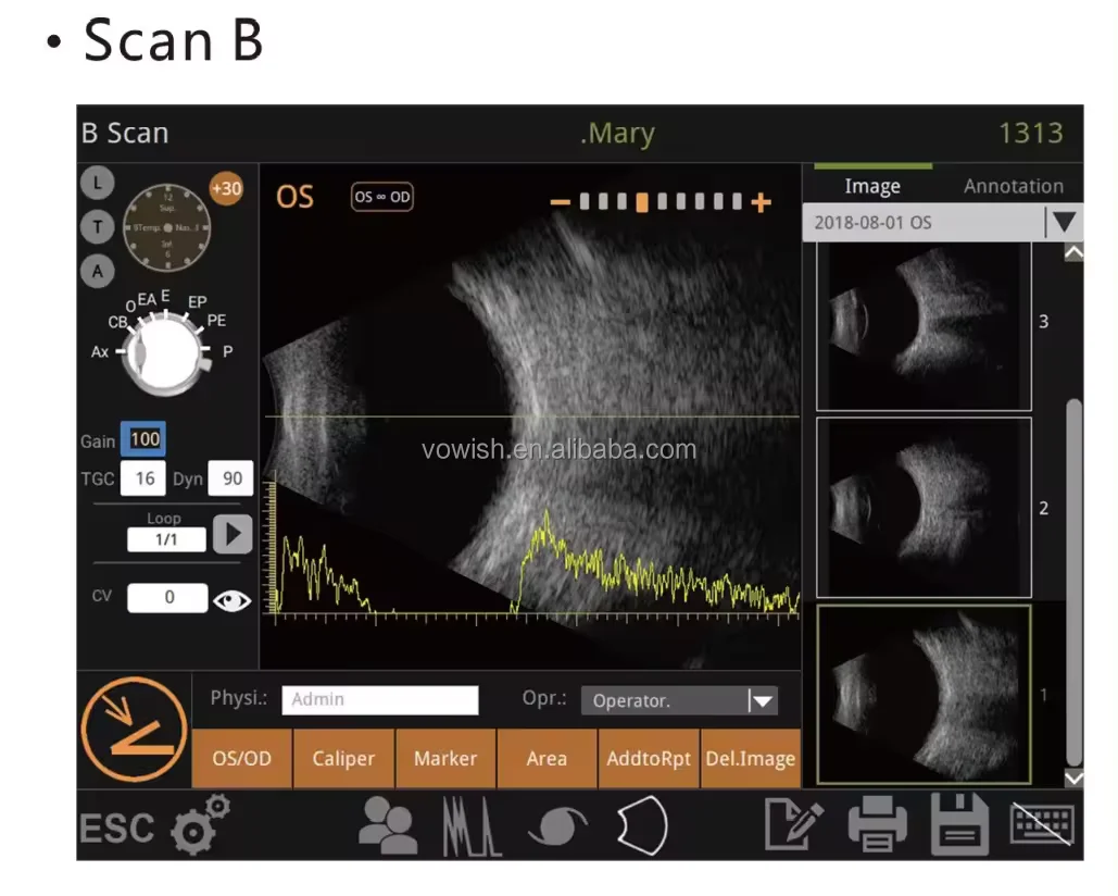 Retiwave 1000 Ophthalmic Ultrasound Machine - A/B Scan