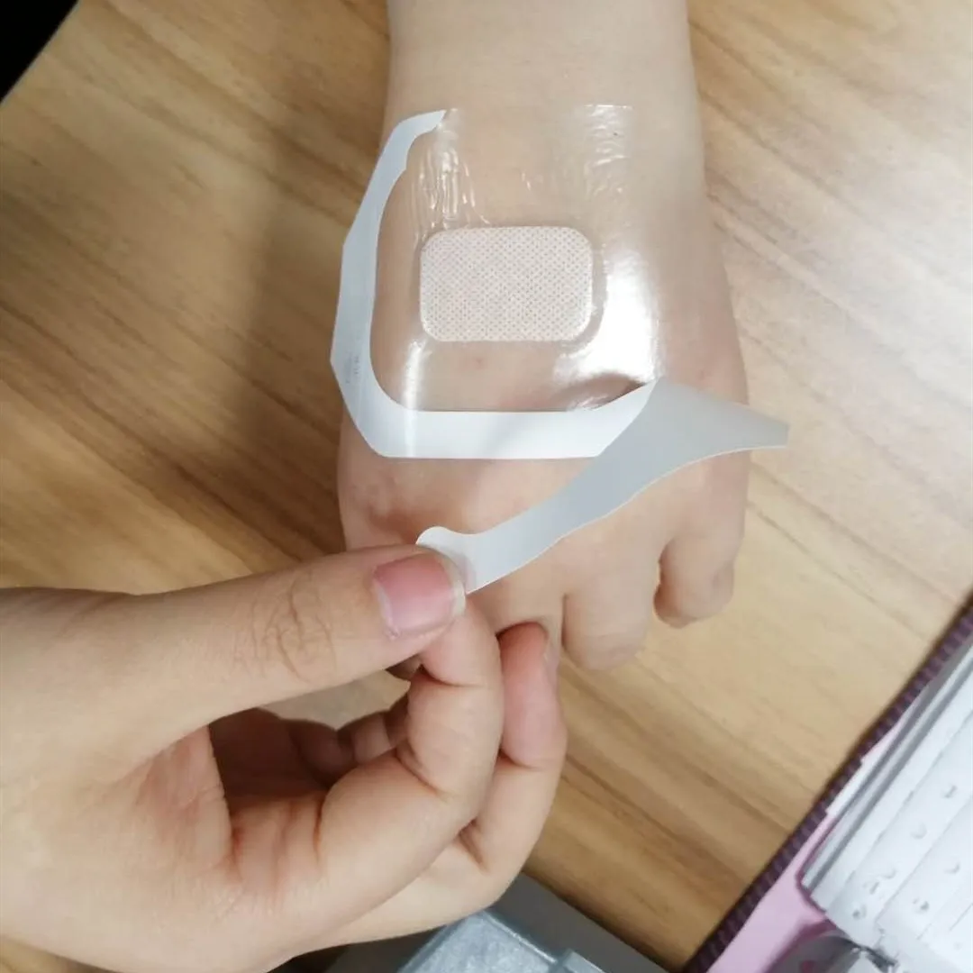 High Quality Catheter Adhesive Island PU Waterproof Medical Wound ...