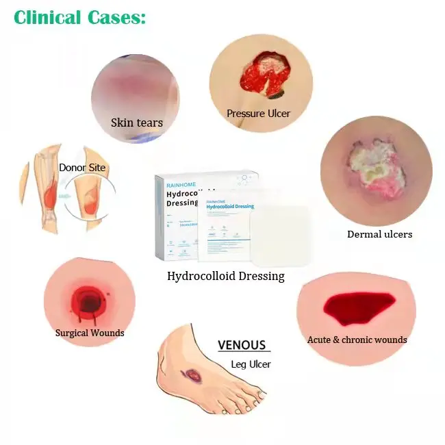 Medical Hydrocolloid Dressing 10x10cm - Silicone Gel Sheets for ...