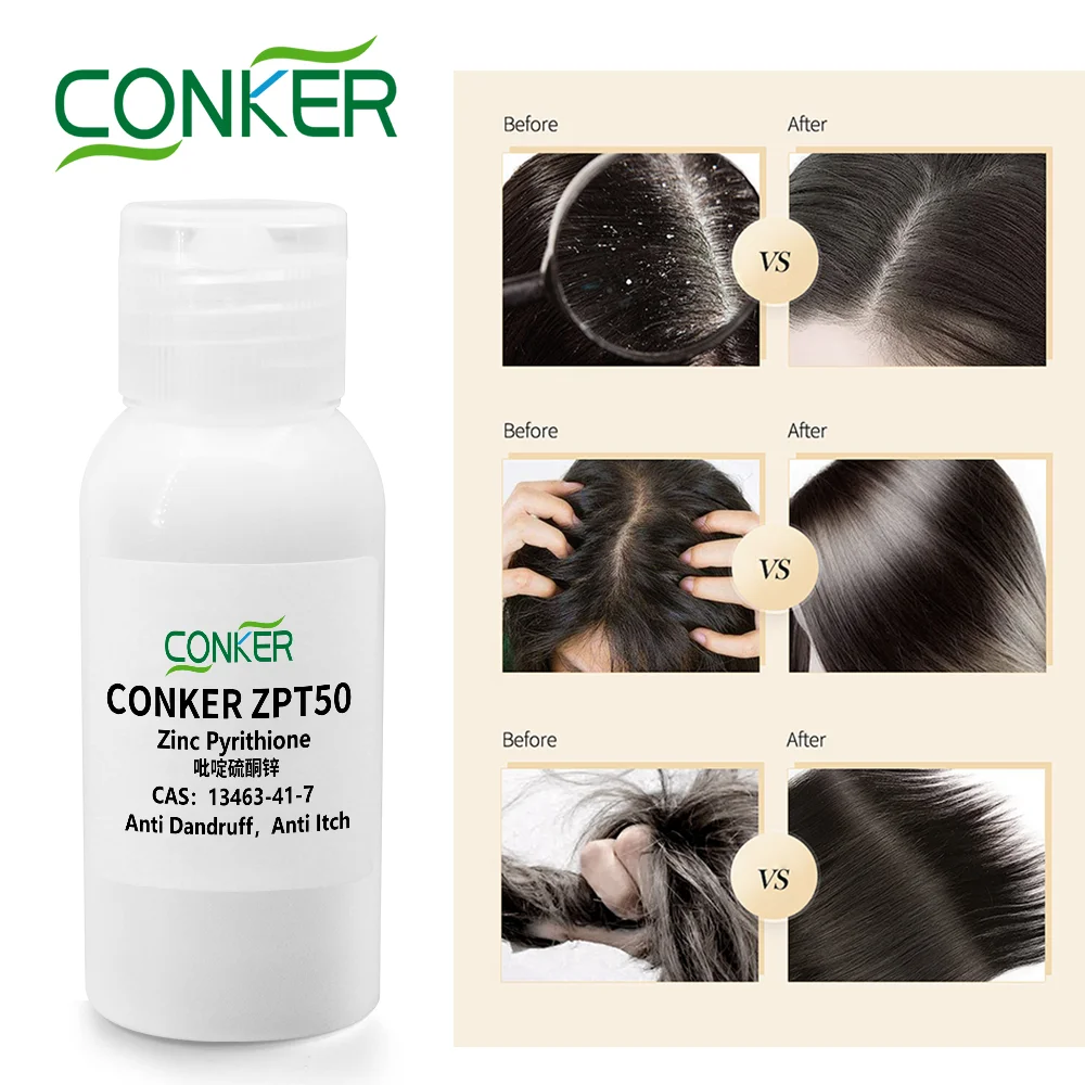 Zinc Pyrithione (ZPT) Liquid | Cosmetic Grade Anti-Dandruff Agent for ...