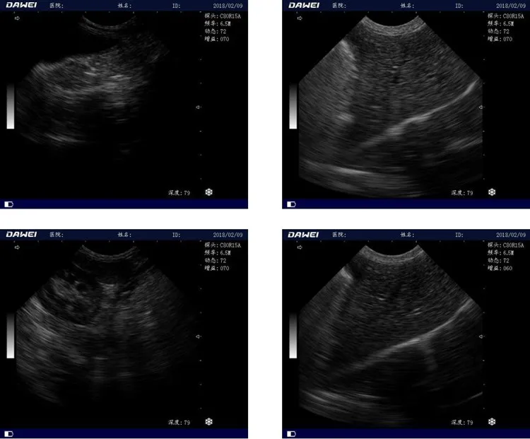 Cow Laptop Ultrasound Horse Sonar Scanner Rectal Probe Pregnancy Tester ...