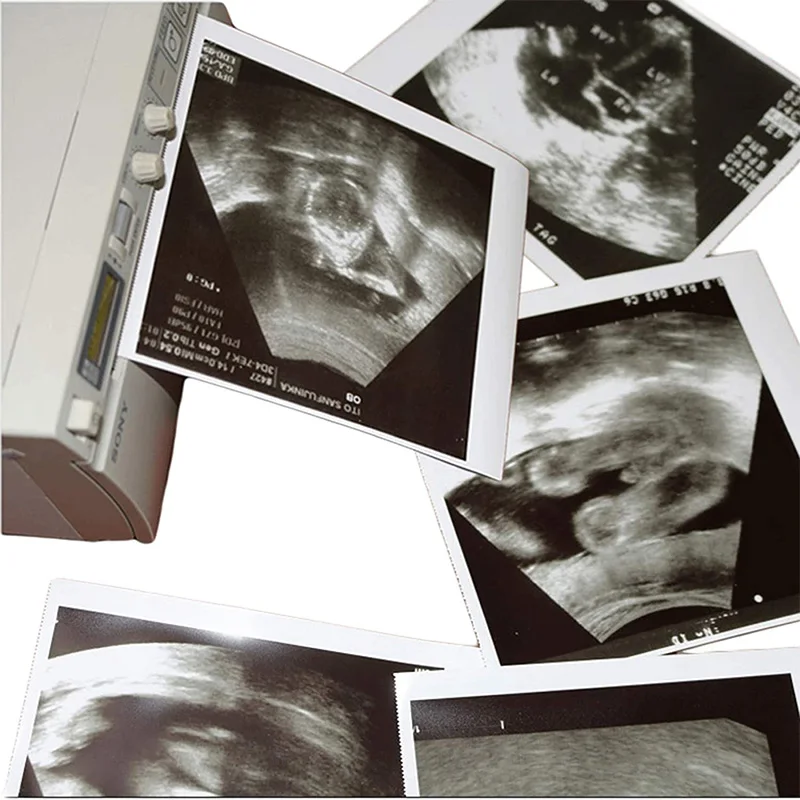 UPP-110HG Ultrasound Thermal Printing Paper for Sony Printers