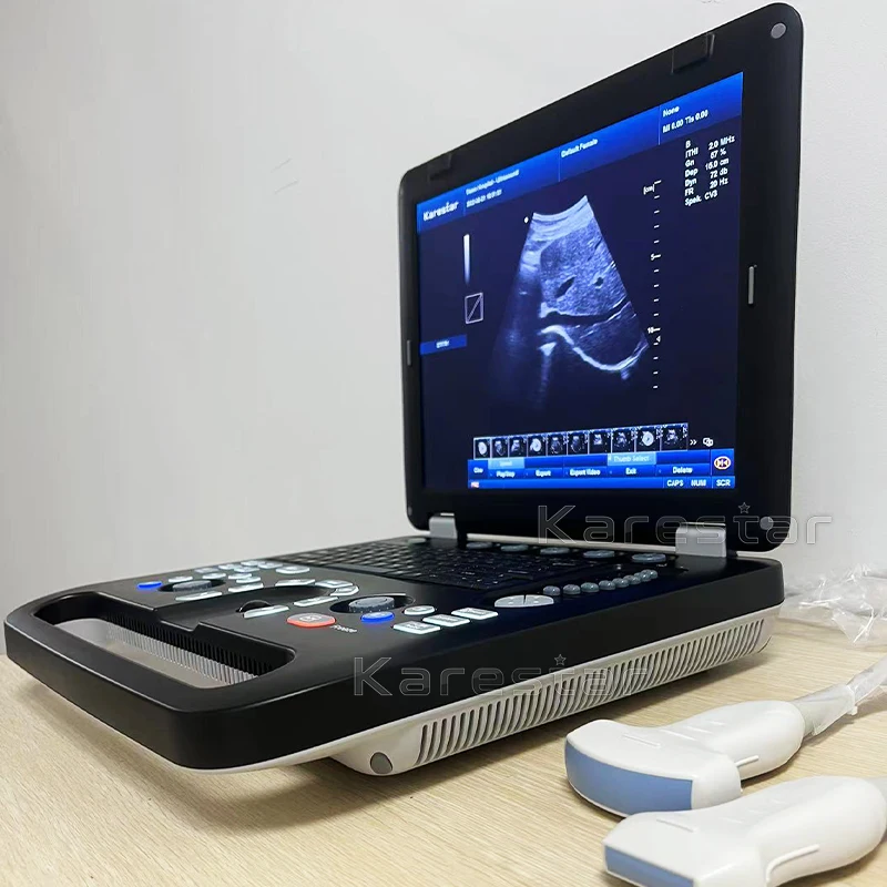 Portable Medical 3d 4d Echocardiography Ultrasound Machine Color ...