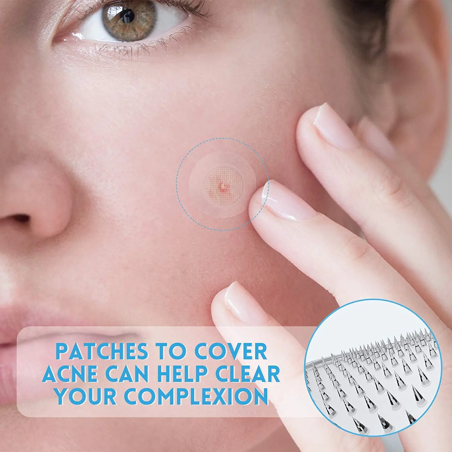 Microneedle Acne Patch - Fast Healing & Waterproof Treatment