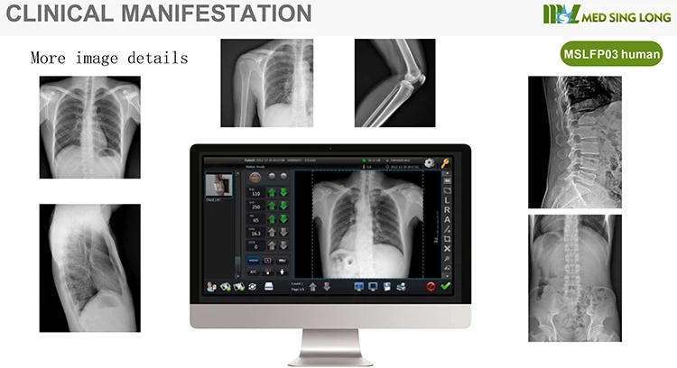 Dr Medic Flat Panel Detector - High Quality X-Ray Imaging