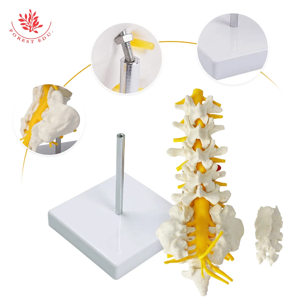 Lumbar Vertebrae Spine Anatomical Model High Quality Disc Herniation ...