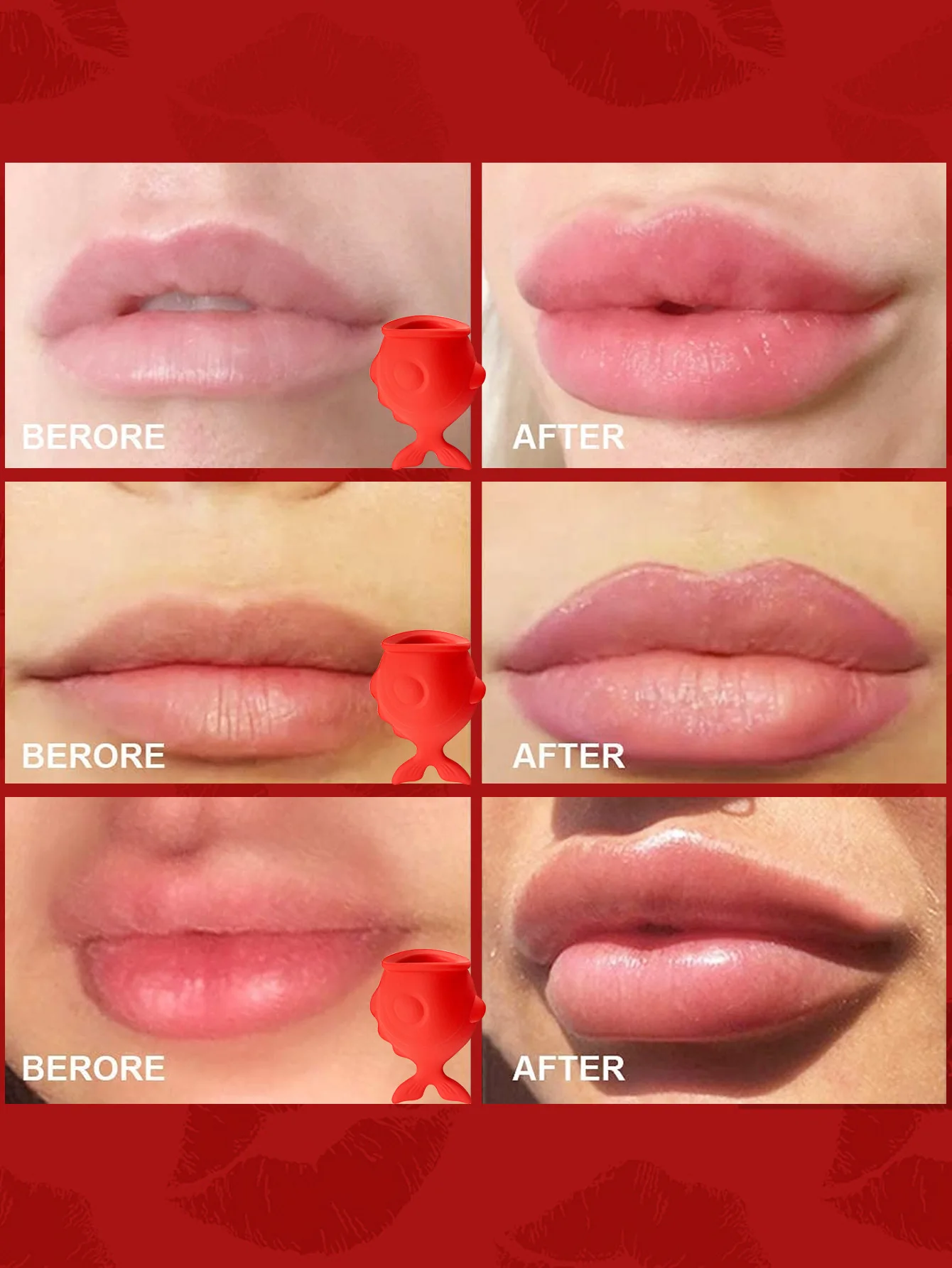 Silicone Goldfish Shape Egg Yolk Separator Suction Lip Enhancer Plumper ...