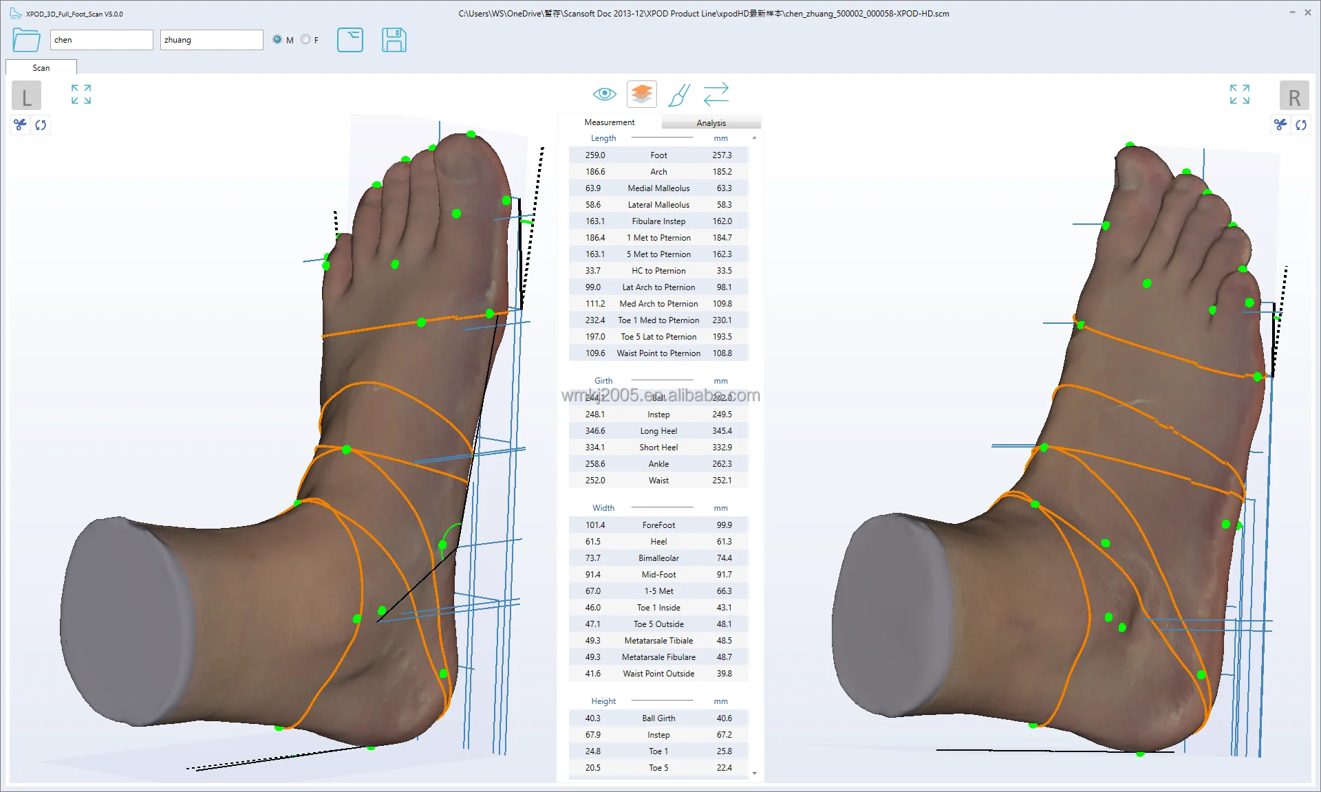 Vismach XPOD-HD Foot Scanner - Customized Orthotic Support