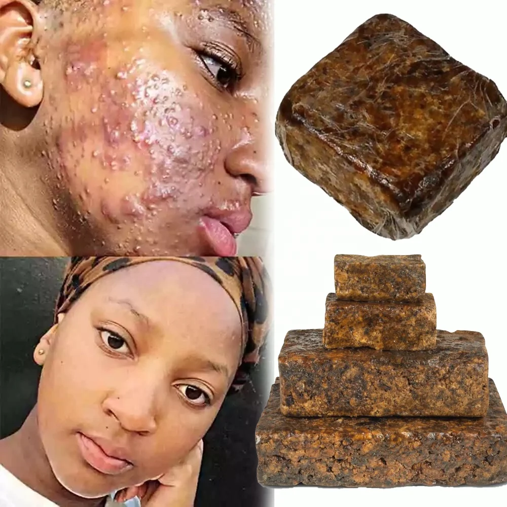 African Black Soap Bar Shea Butter Acne and Dark Spots Removal Smooth Skin Face Body and Hair soaps