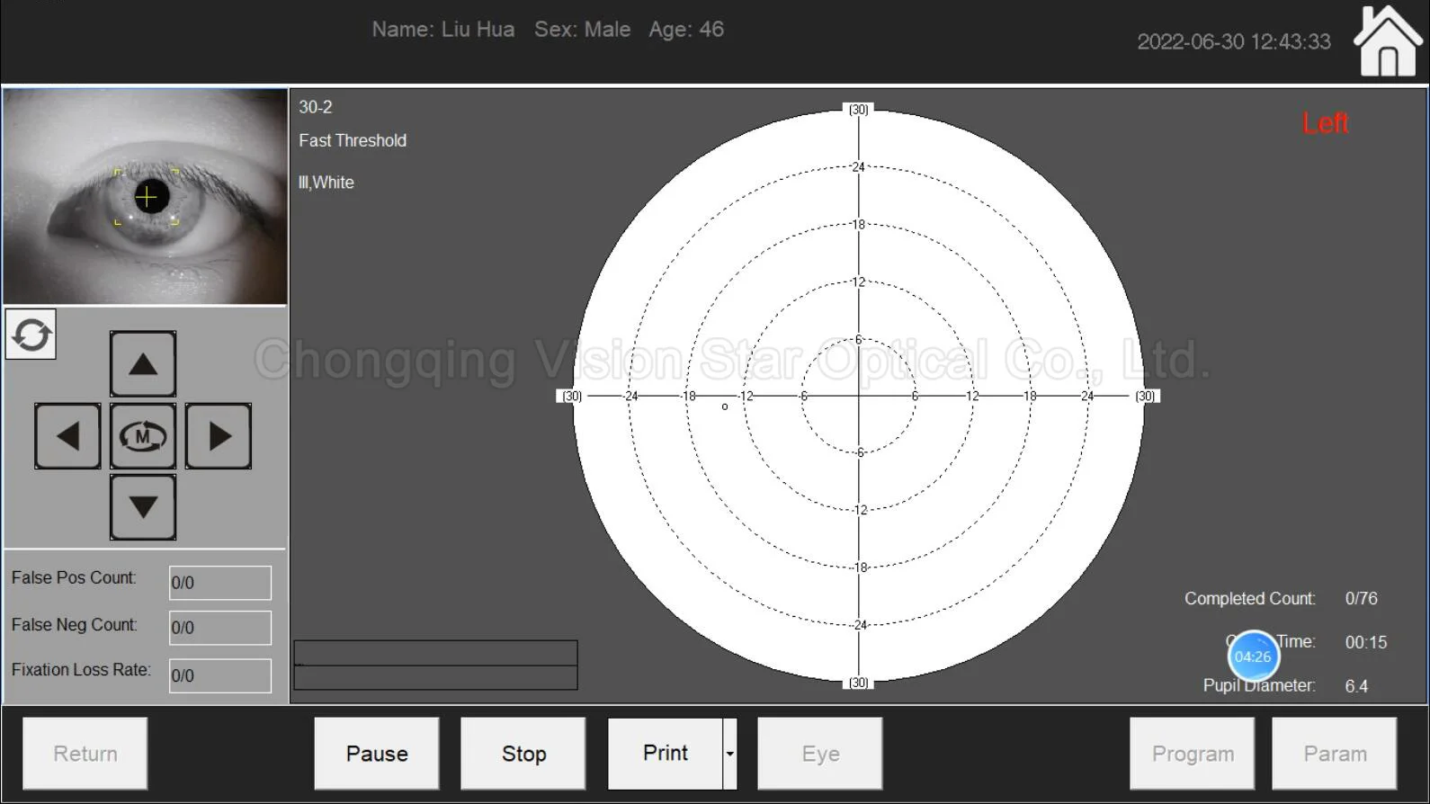 Computer Built-in Ophthalmic Automatic Eye Projection Perimeter Visual ...