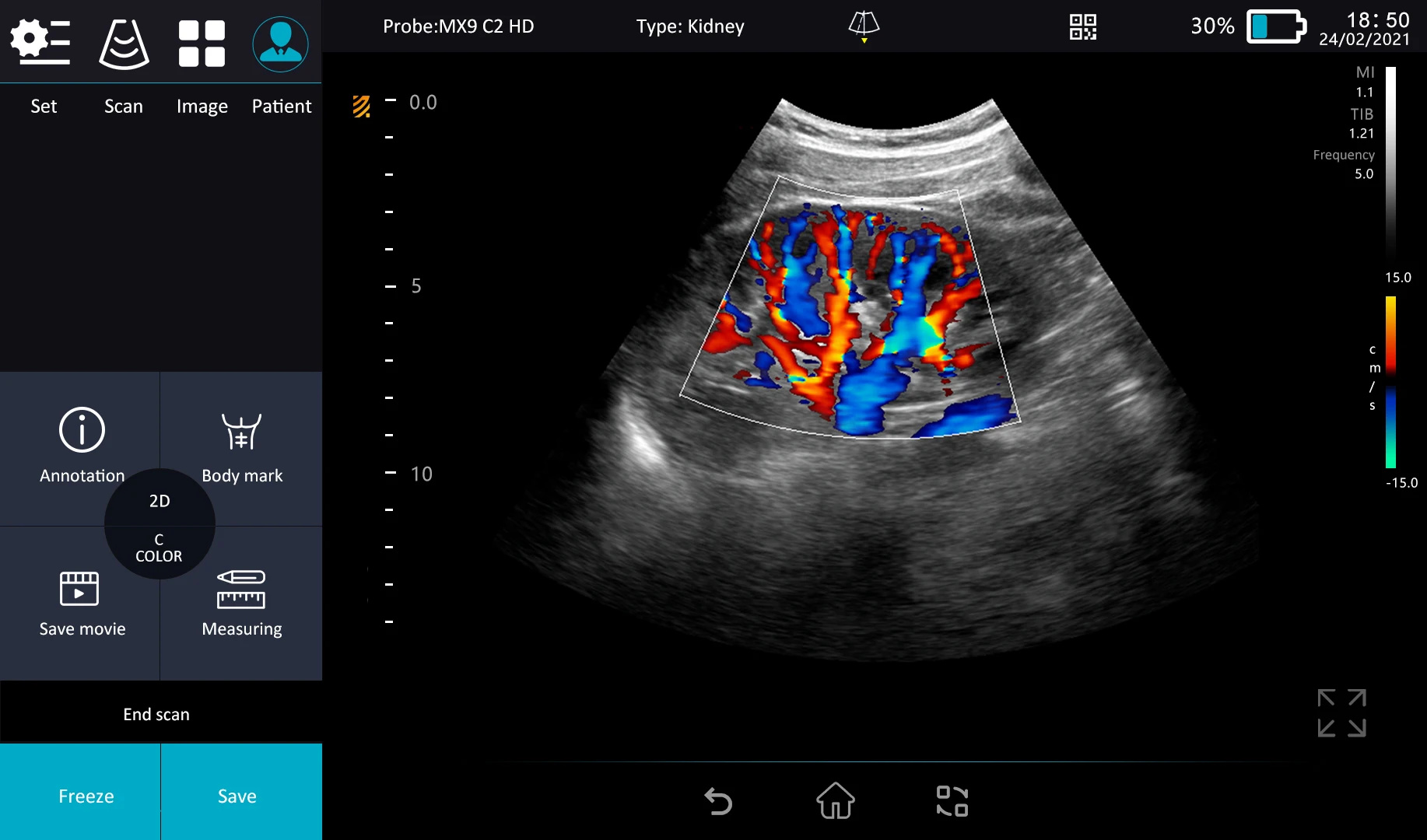 USB Ultrasound Medical Scans - Convex Linear Probe BMV MX9