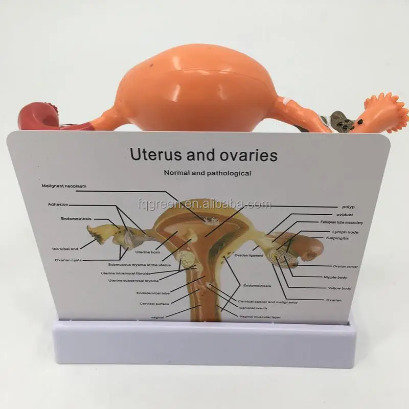 Pathological Uterus Model Medical Female Model For Demonstration - Buy ...