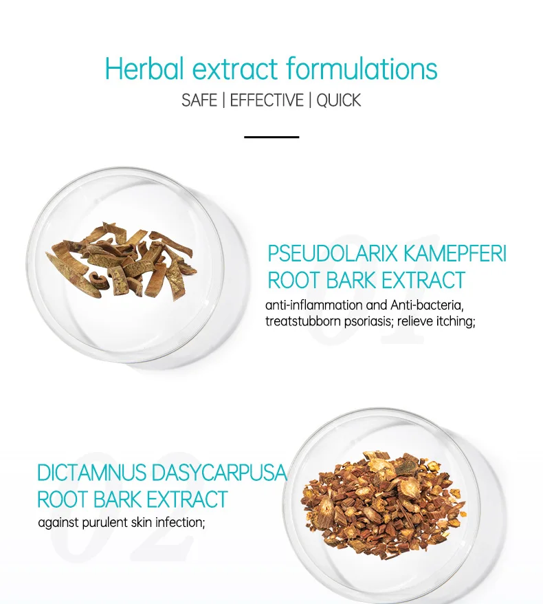 Skin Pruritus Ointment Skin Ringworm Wang Ointment Dispel Psoriasis ...