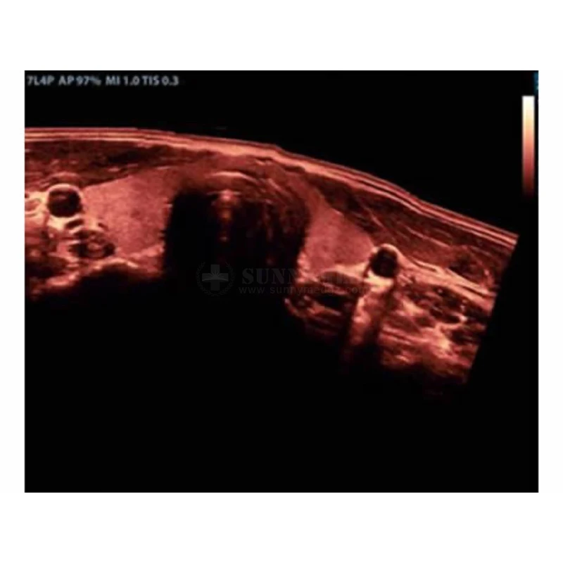 Mindray Z50 Ultrasound - Advanced Portable Color Doppler