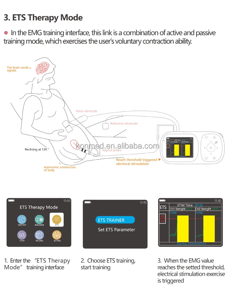 Pelvic Floor Stimulator Pelvic Floor Muscle Pain Relief Stimulator ...