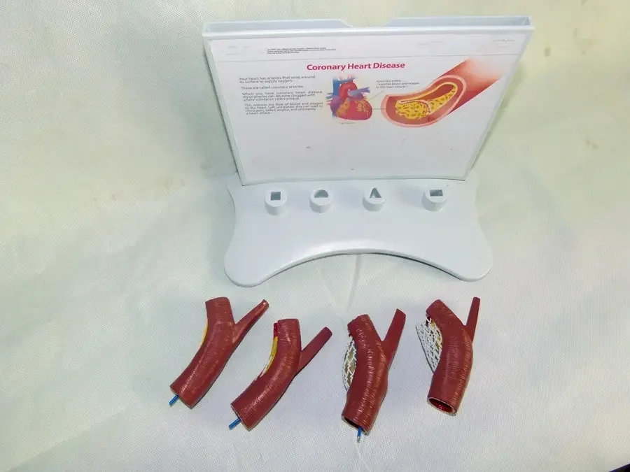 Vascular Stent Model Human Vascular Model Medical Human Teaching ...
