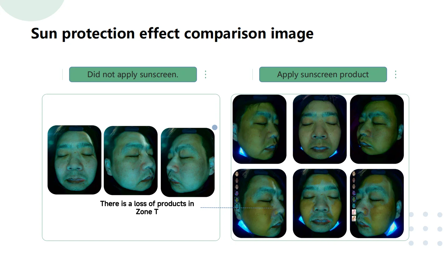 Professional 3D Skin Scanner for Facial Analysis AI Diagnostic Machine ...