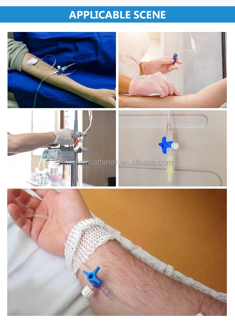 Disposable Medical Anesthesia Arterial Catheter Invasive PU AC Kit ...