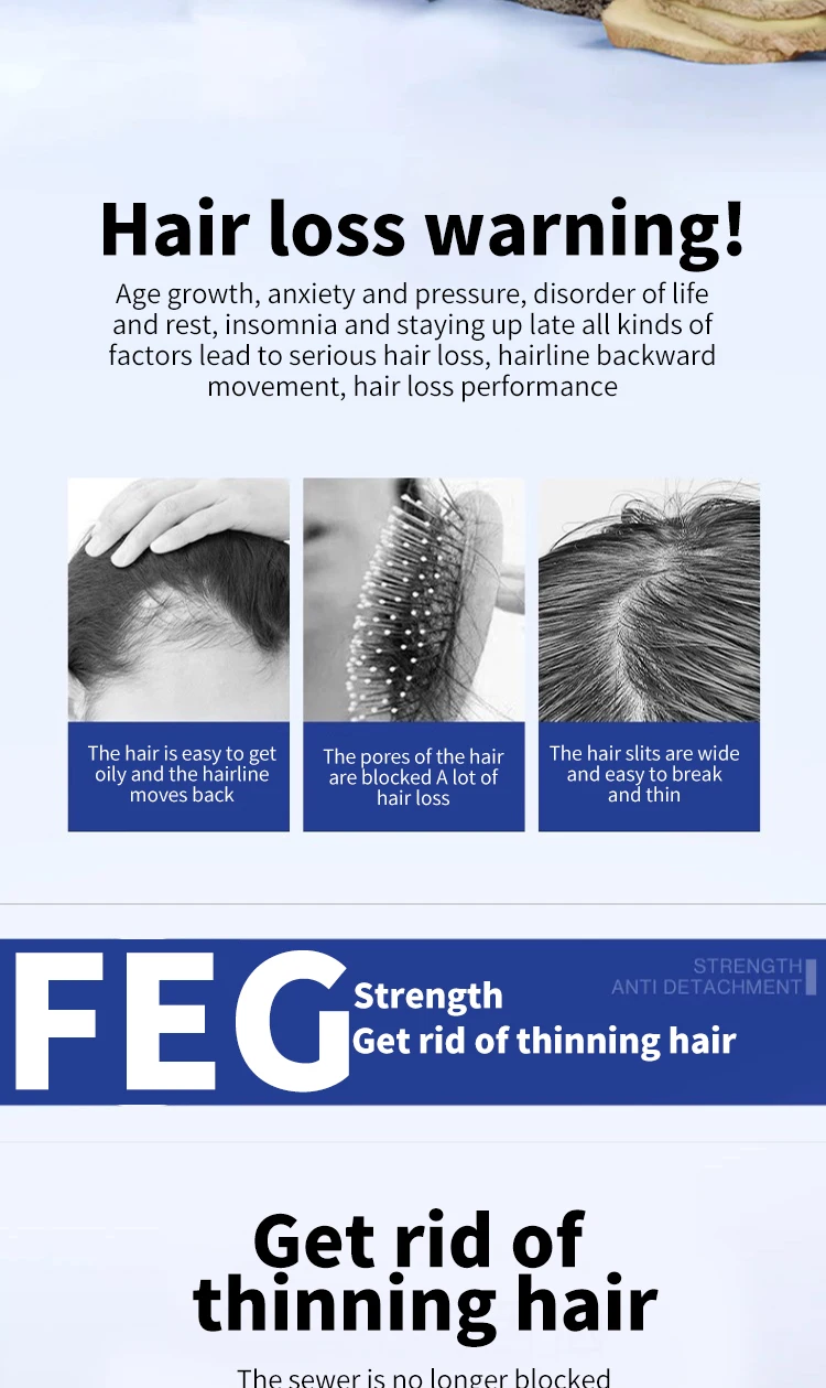 FEG Hair Growth Spray - Prevent Hair Loss & Promote Growth