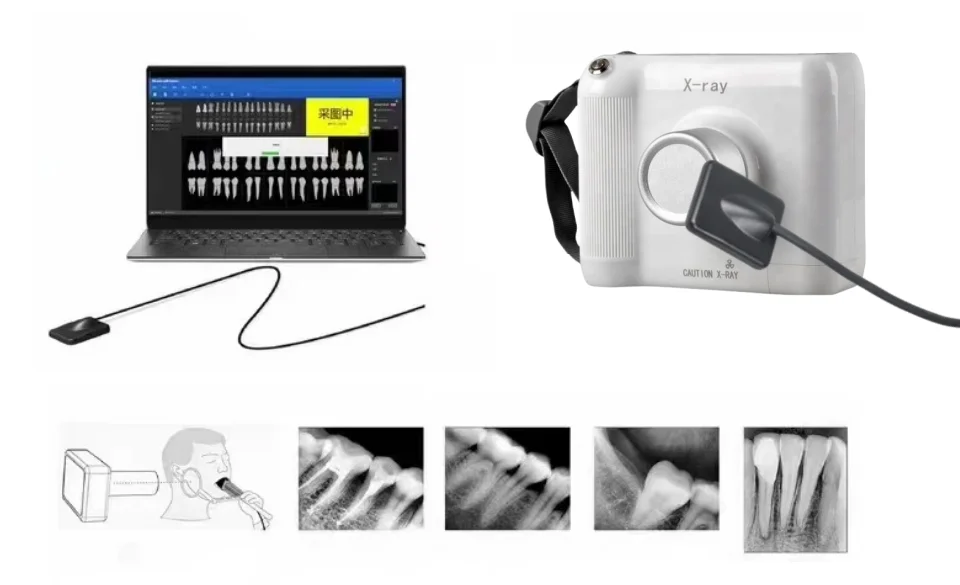 Yj-hdr1 Dental Xray Sensor Digital X-ray Photon Counting Rvg Sensor ...